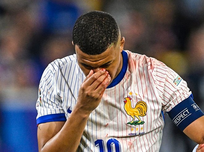 Mbappe được gợi ý đeo mặt nạ Ninja Rùa sau chấn thương vỡ mũi tại EURO ...